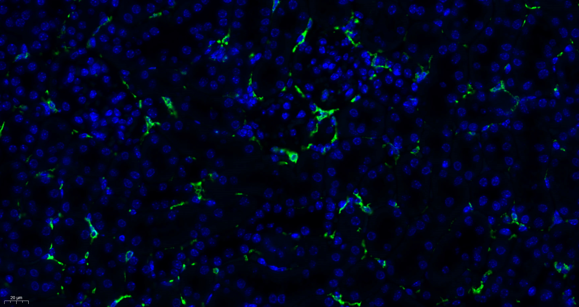 CD68 - 上海慧蓝生物科技有限公司